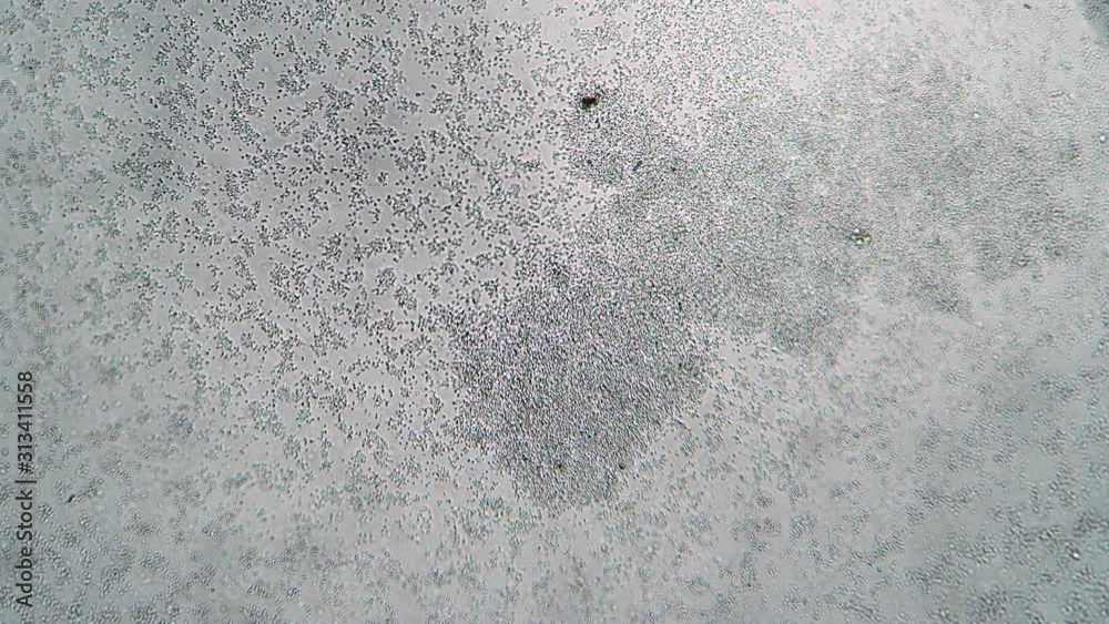 Huge amount of bacteria in a drop of water under a microscope. Theme of ...