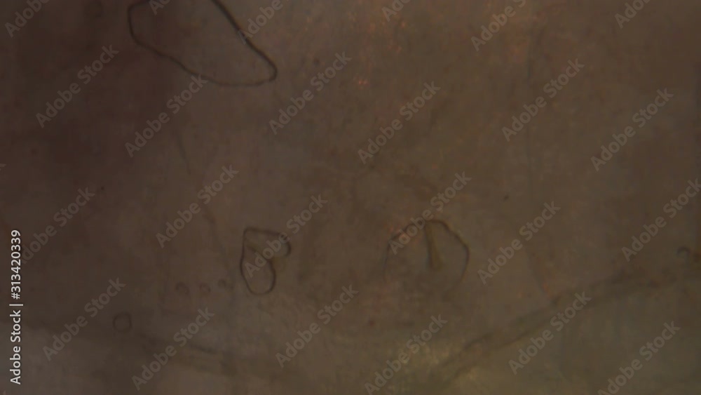 Vidéo Stock Microscopy of caterpillar. Magnification 300x with visible ...