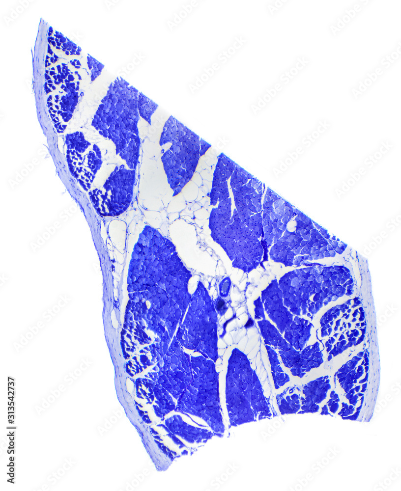Skeletal muscle tissue longitudinal section under a microscope Stock ...