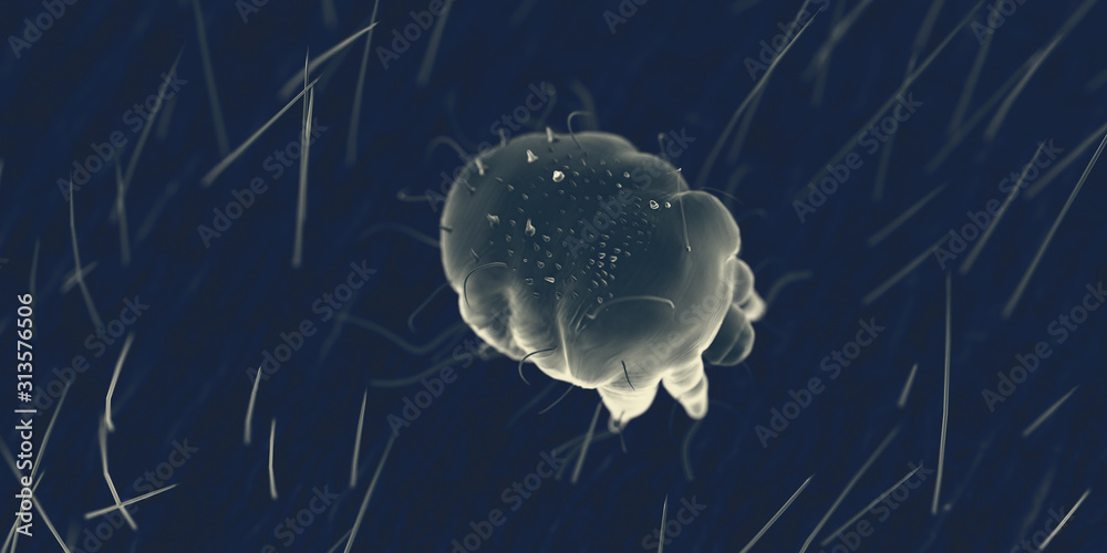 3d rendered illustration of a scabies mite on human skin, sem style ...