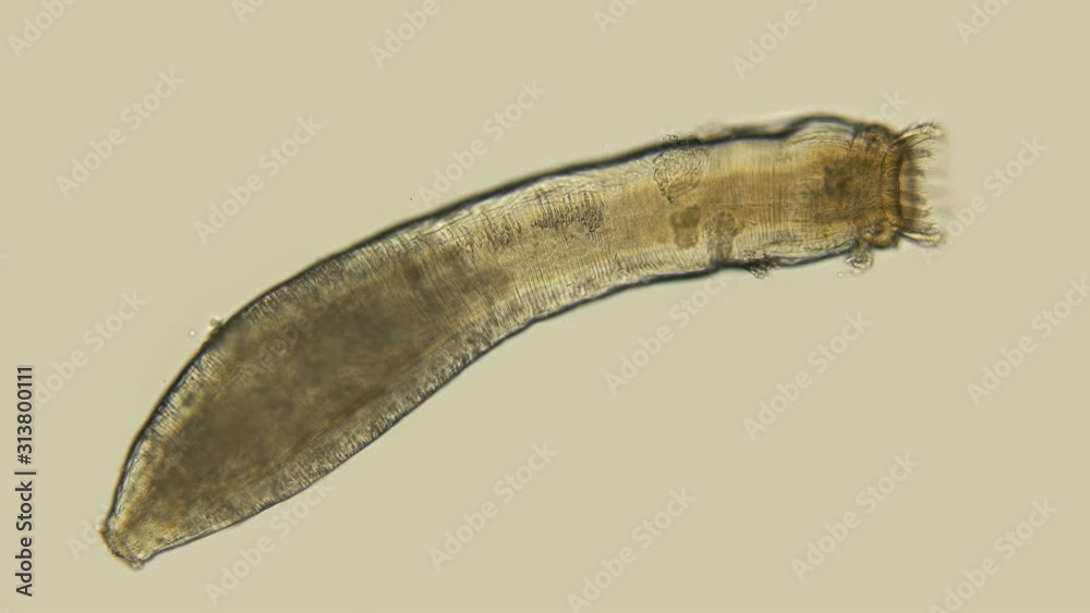 microscopic sea cucumber, class Holothuroidea, Synaptidae family, a ...