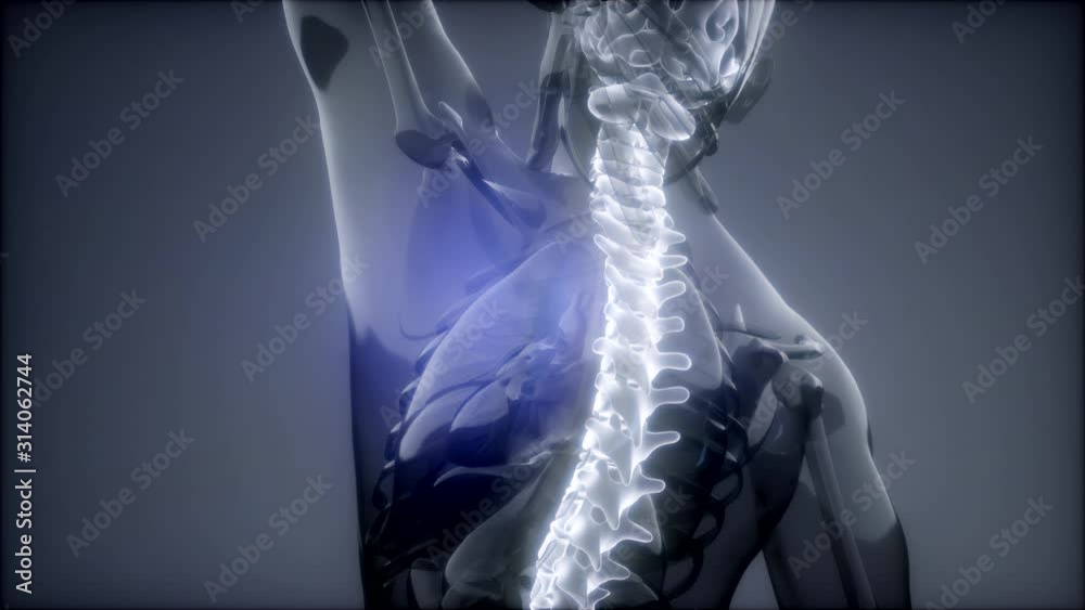 backache in backbone. science anatomy scan of human spine bones glowing ...