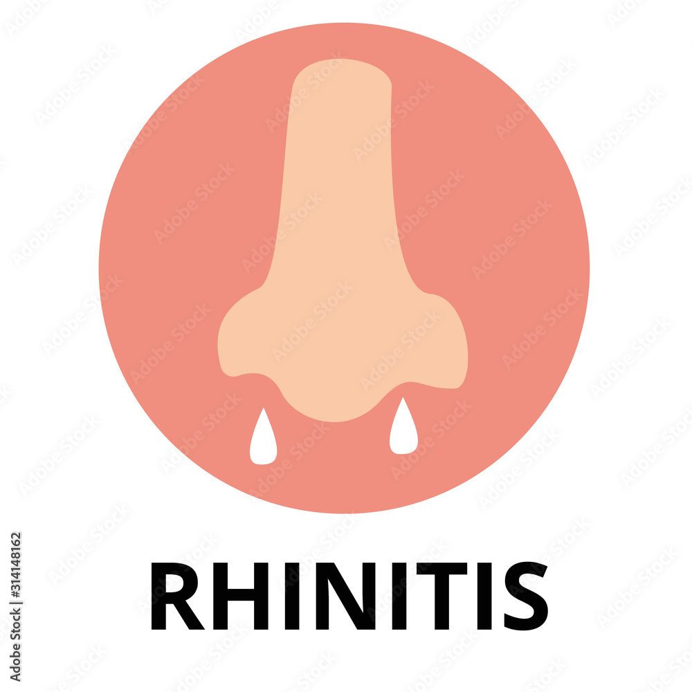 Nasal diseases. Rhinitis symptoms, treatment icon set. Medical ...