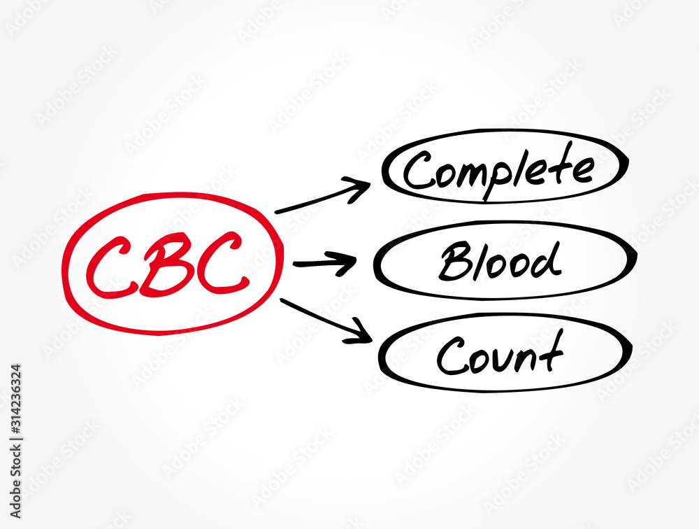 CBC - Complete Blood Count acronym, medical concept background Stock ...
