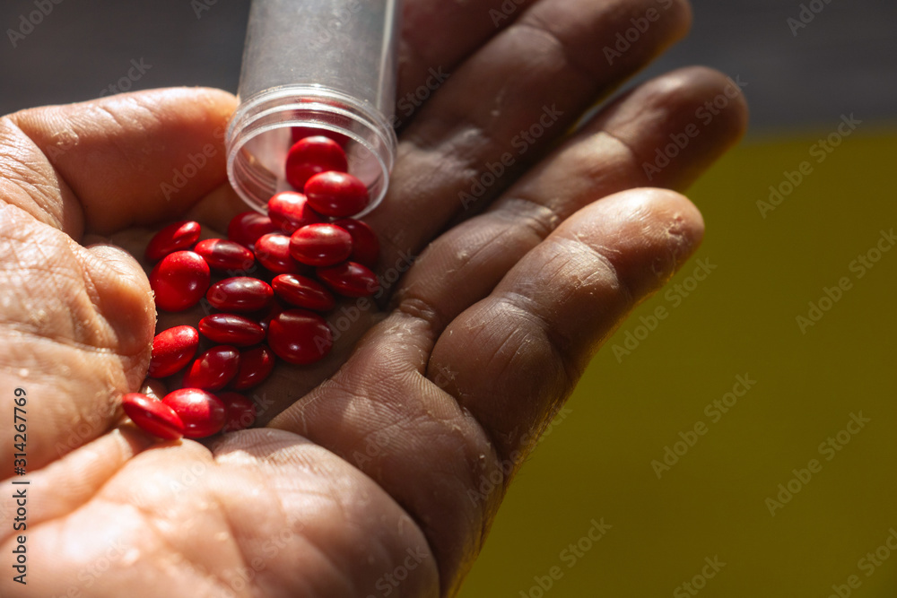 Close – up medicine on hand.A man holding red medicine .Drug,remedy ...