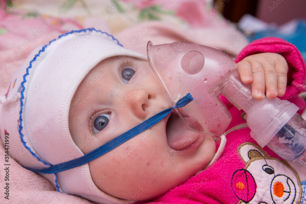 Nebulizer Baby