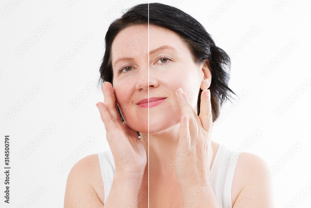 Middle Age Close Up Woman Happy Face Before After Cosmetic Procedures Skin Care For Wrinkled