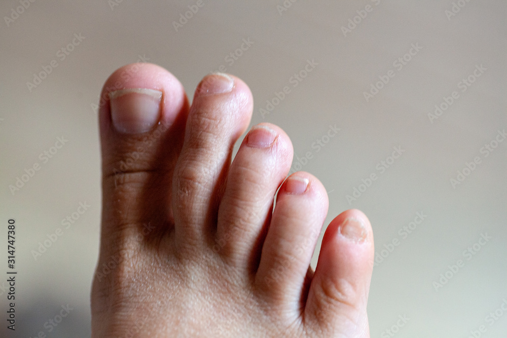 young girl's toes are healthy and beautiful. Well-groomed Concept for ...