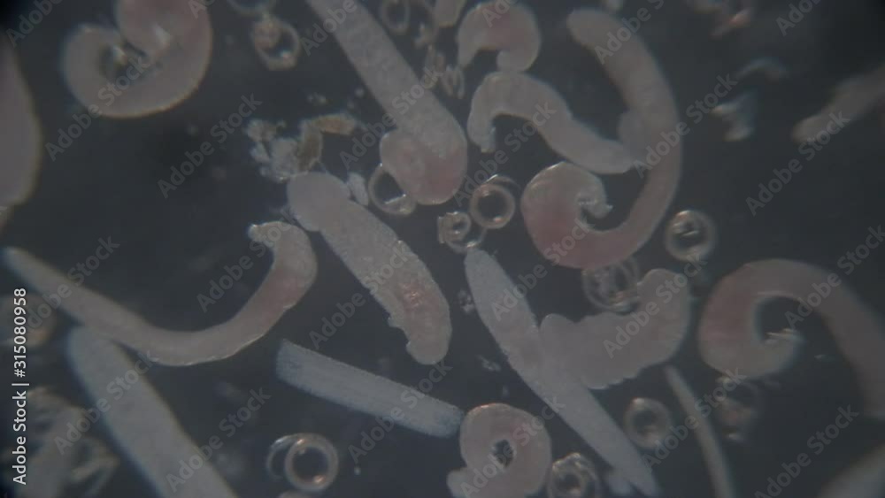 Video Stock Schistosoma is a genus of trematodes, commonly known as ...