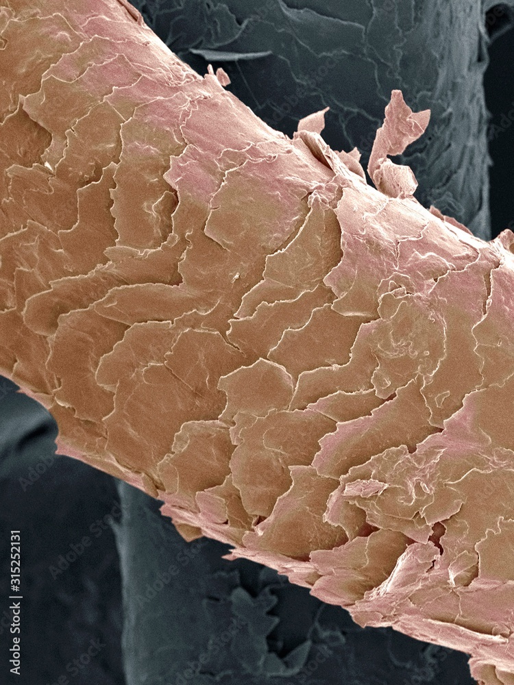 Human hair, SEM Stock Photo | Adobe Stock