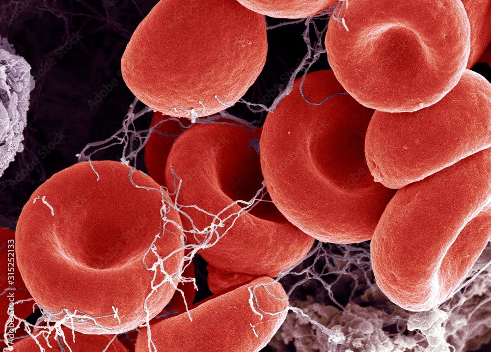 Blood clot, SEM Stock Photo | Adobe Stock