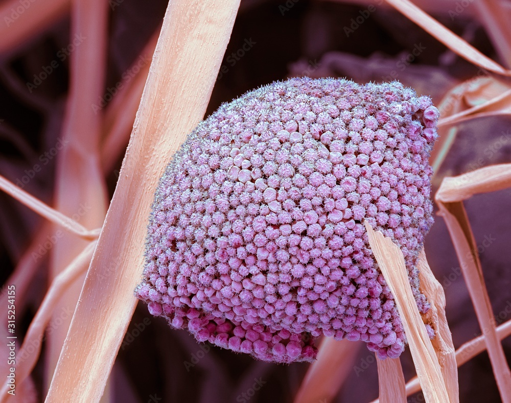Fungal cells, SEM Stock Photo | Adobe Stock