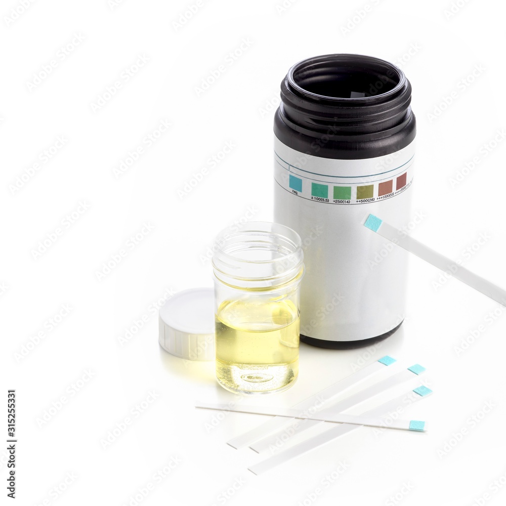 Medical sample and pH test strips Stock Photo | Adobe Stock