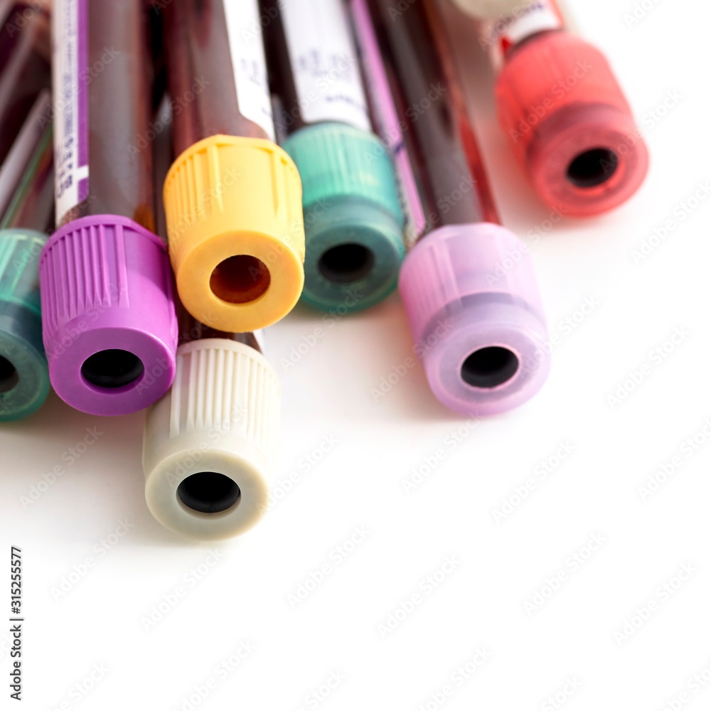 Blood collection tubes Stock Photo | Adobe Stock