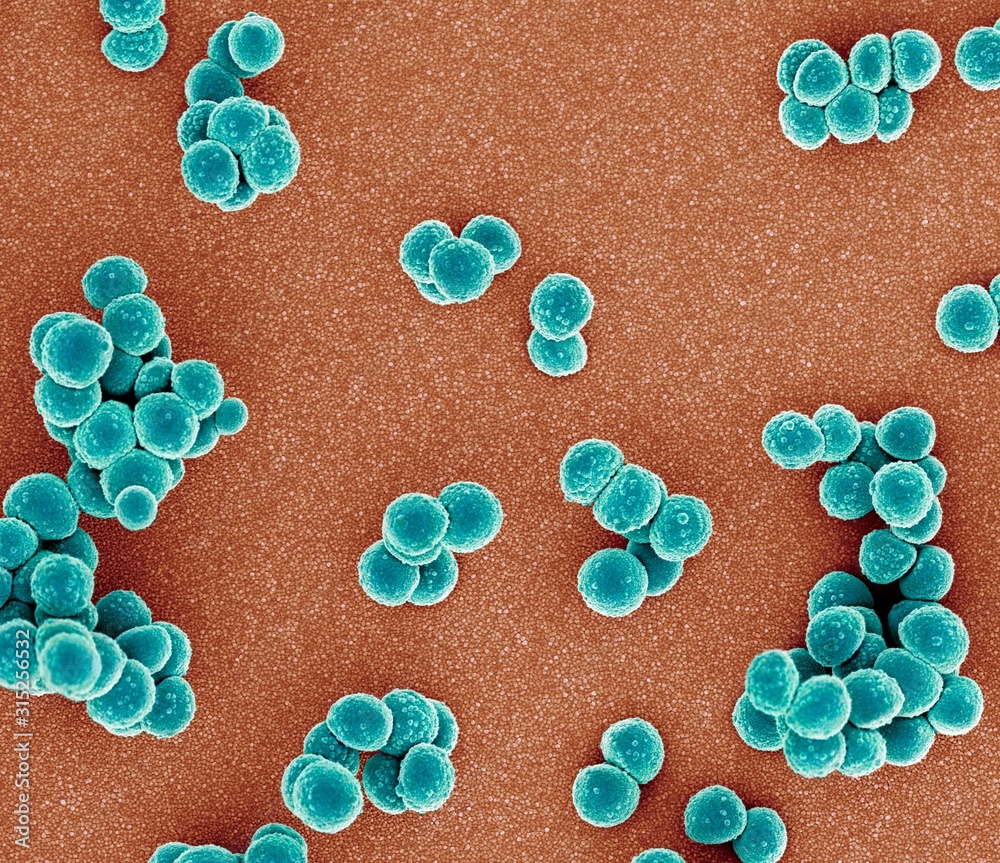 MRSA bacteria, SEM Stock Photo | Adobe Stock