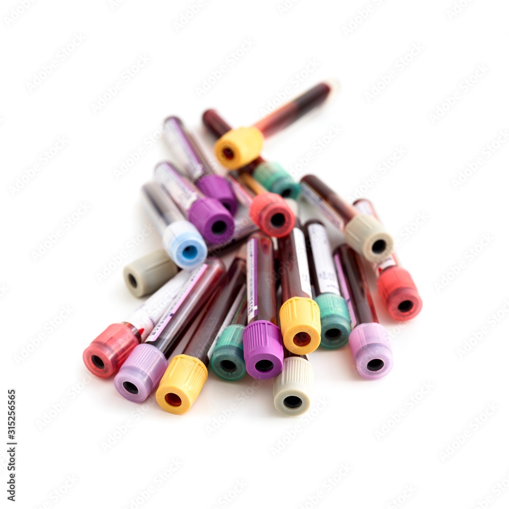 Blood collection tubes Stock Photo | Adobe Stock
