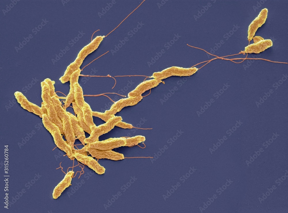 Campylobacter jejuni bacteria, SEM Stock Photo | Adobe Stock