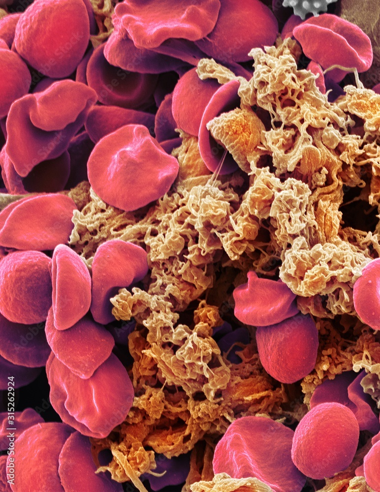 Red blood cells and platelets, SEM Stock Photo | Adobe Stock