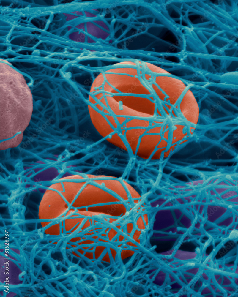 Red blood cells in a blood clot, SEM Stock Photo | Adobe Stock