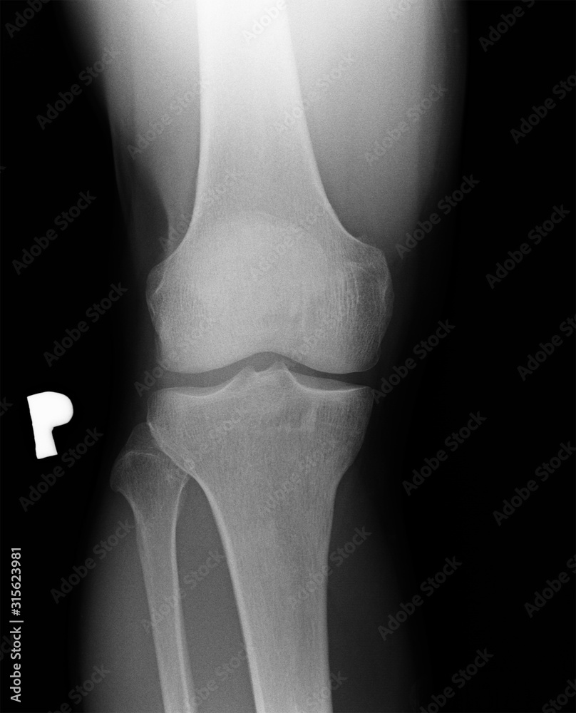 Preventive and control medical examination. X-ray of the right man's ...