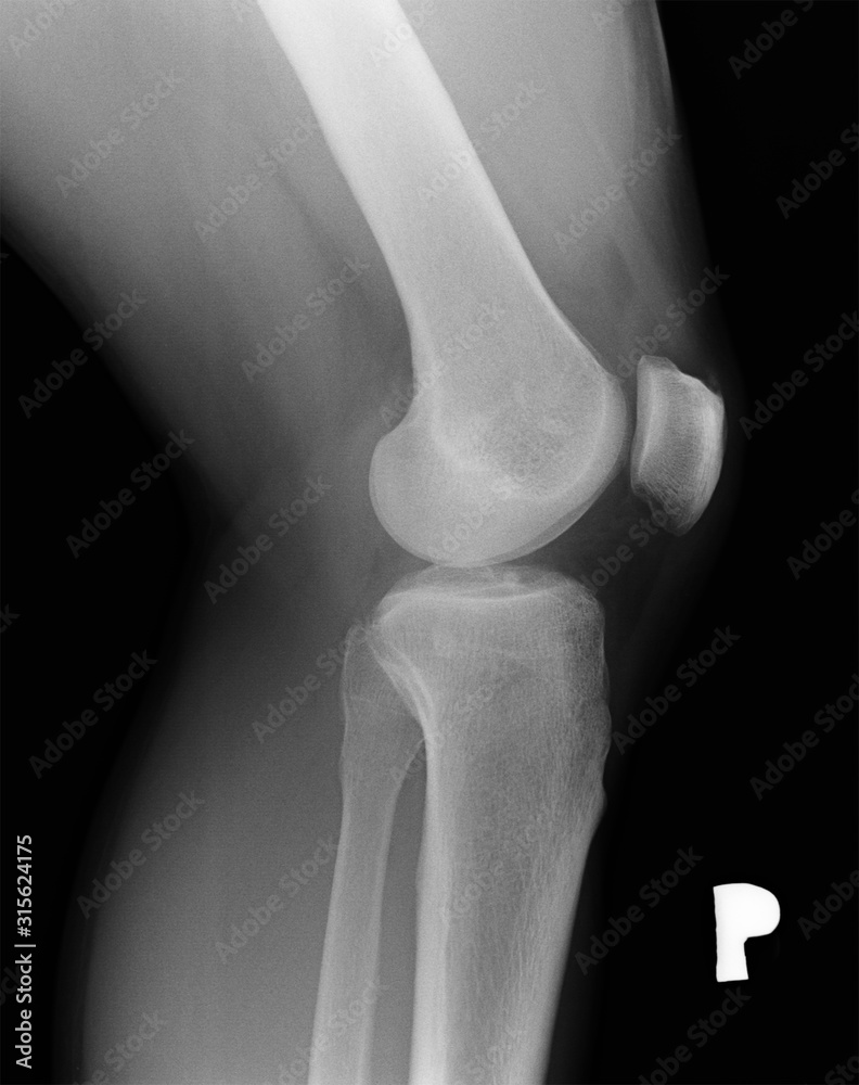 Preventive and control medical examination. X-ray of the right man's ...