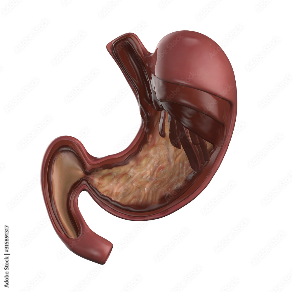 Human Stomach Dissection