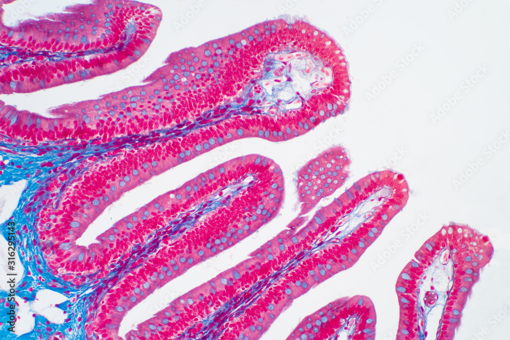 Human large intestine tissue under microscope view. Stock Photo | Adobe ...