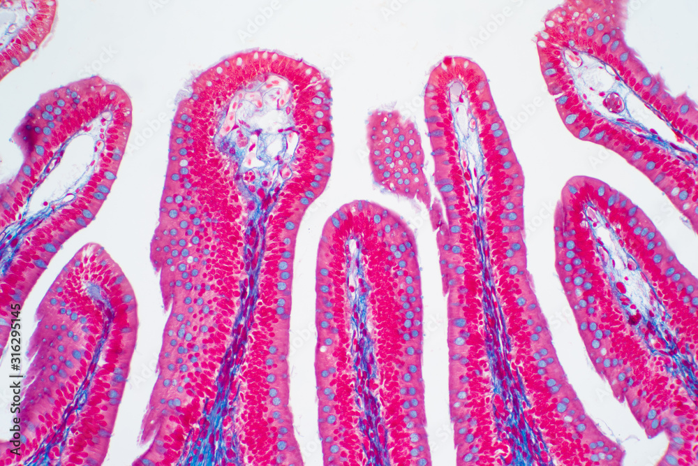 Human large intestine tissue under microscope view. Stock Photo | Adobe ...