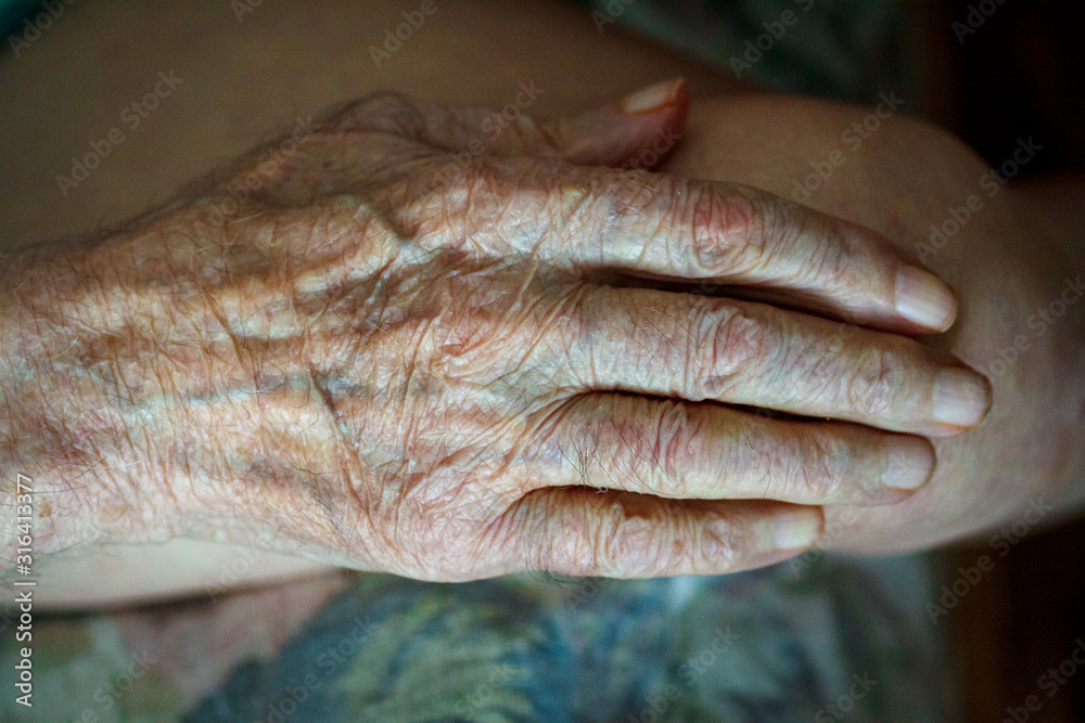 The process of aging of human skin - wrinkled hands of a very old man ...