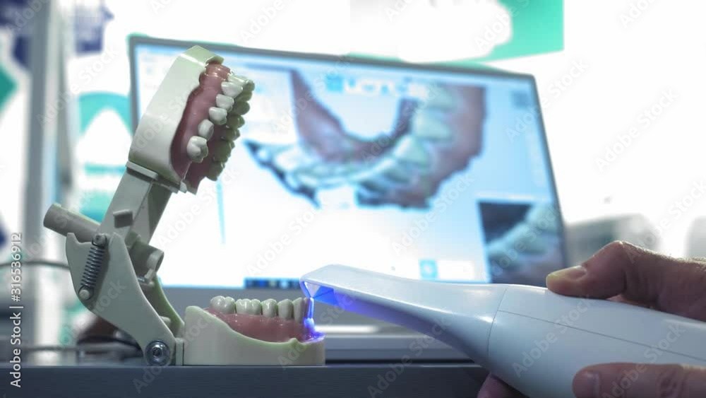 Manual 3D scanner for teeth. The doctor scans a cast of teeth on the ...