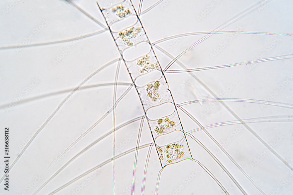 Chaetoceros is marine planktonic diatoms under microscope view. Stock ...