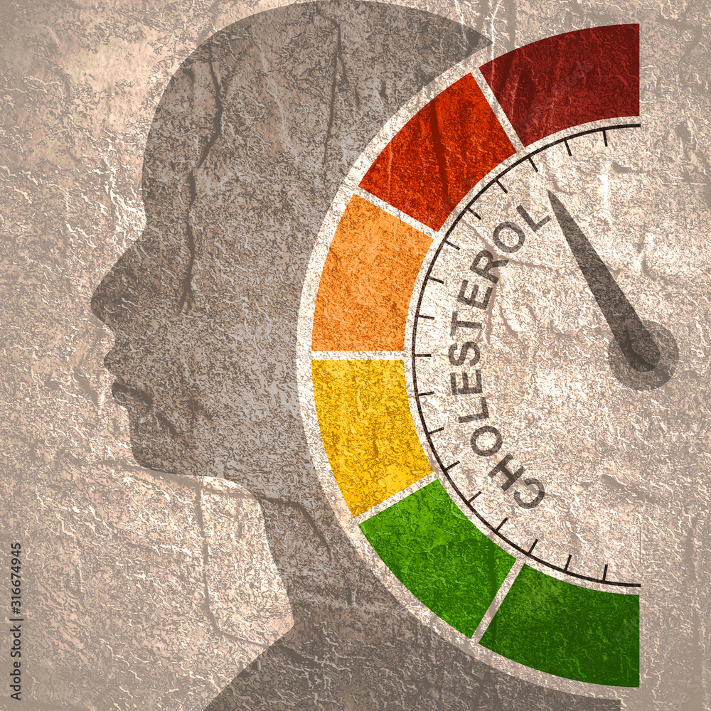 Cholesterol meter read high level result. Color scale with arrow from ...