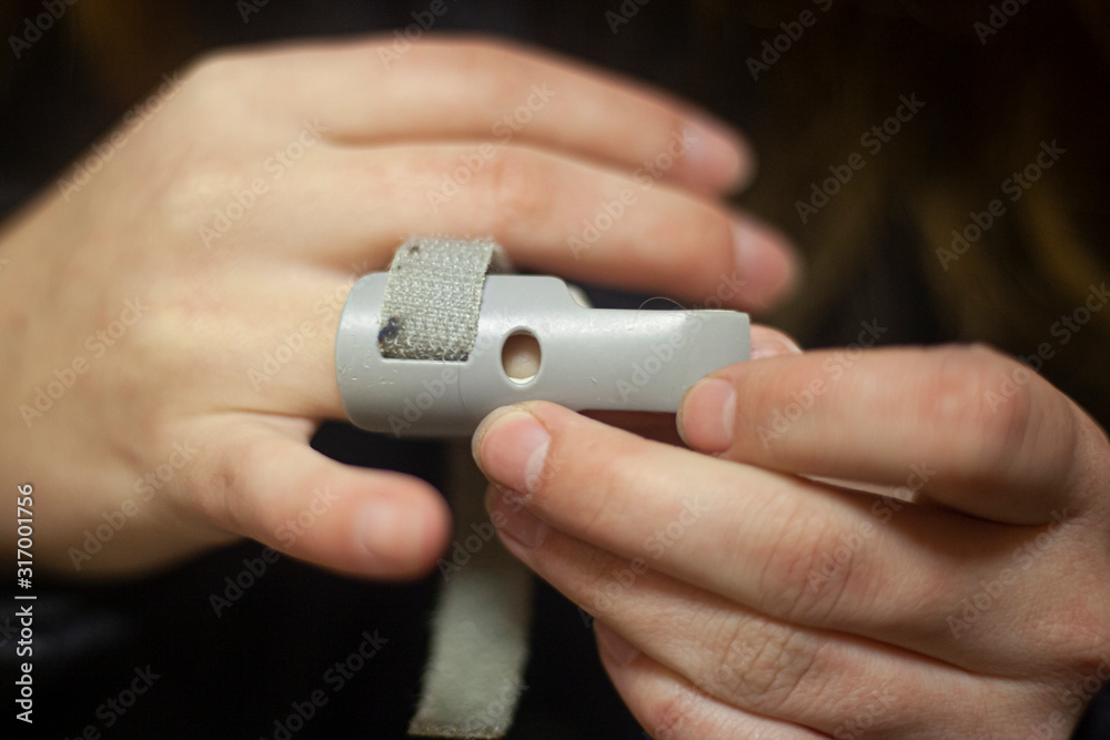 Applying a bandage to a broken finger. Fixing a broken finger for bone ...