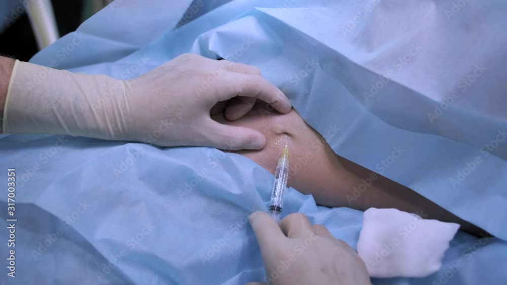 Inserting a needle under the skin of the armpit. Armpit injection Stock ...