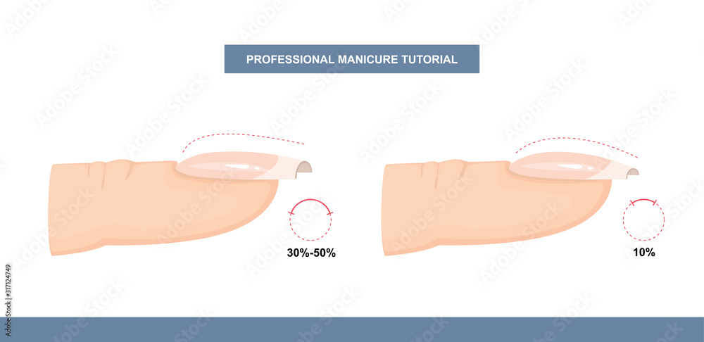 Different Shapes of Nail Plate. Side View. Nail Apex and C-curve ...