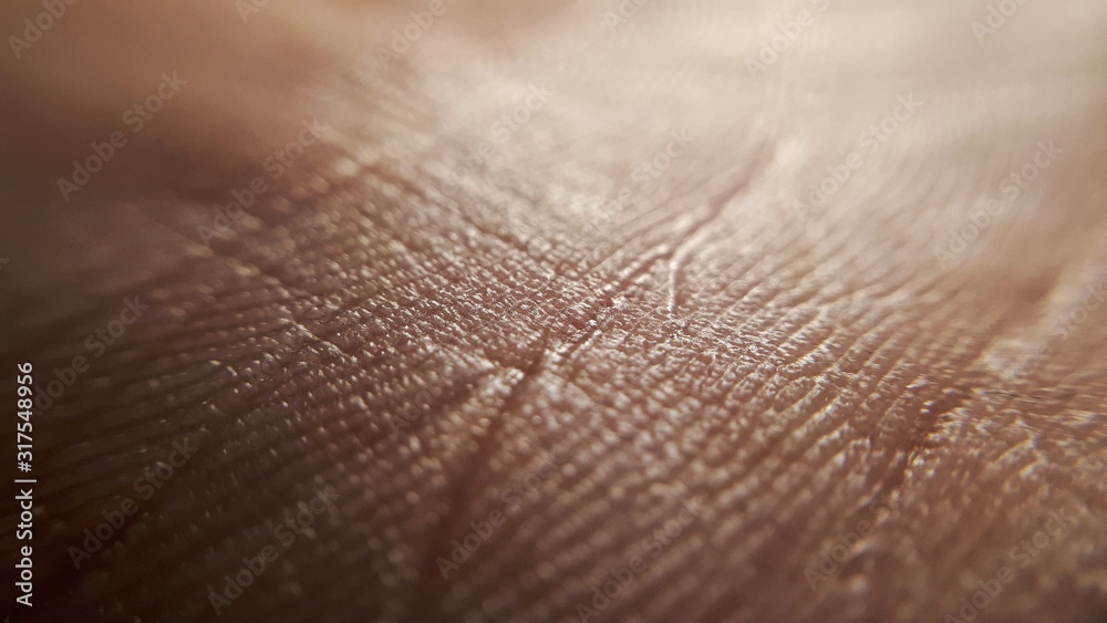 Skin diseases concept. macro skin of human hand.Medicine and ...