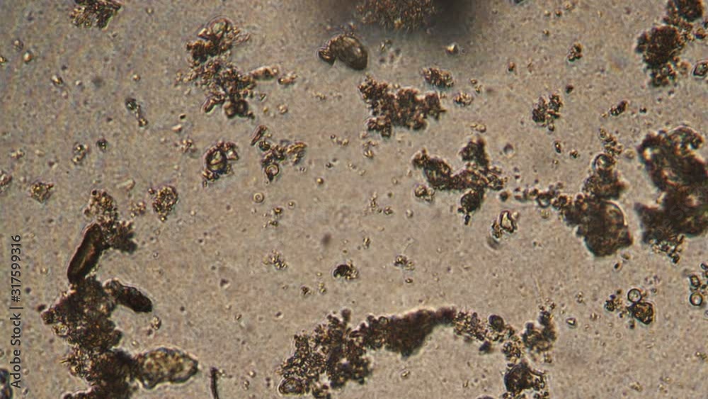 Microscopy of protozoa ciliate and small microorganisms in the water ...