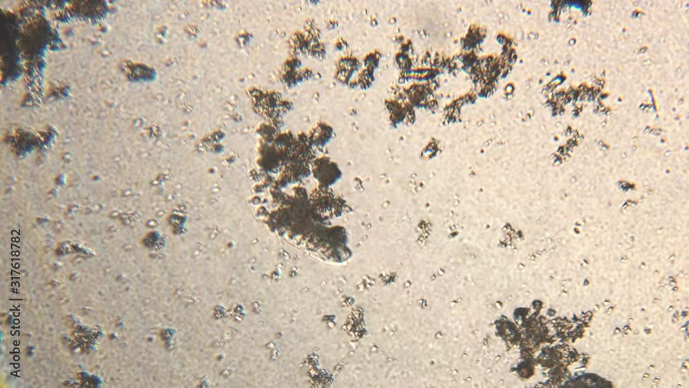 Microscopy of protozoa ciliate and small microorganisms in the water ...