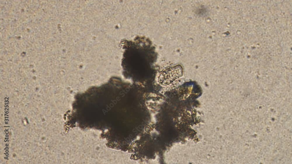 Microscopy of ciliary ciliates (Cothurnia sp.) in the water sample. Infusoria attached to the ...