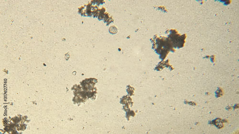 Video „Microscopy of protozoa ciliate and small microorganisms in the ...