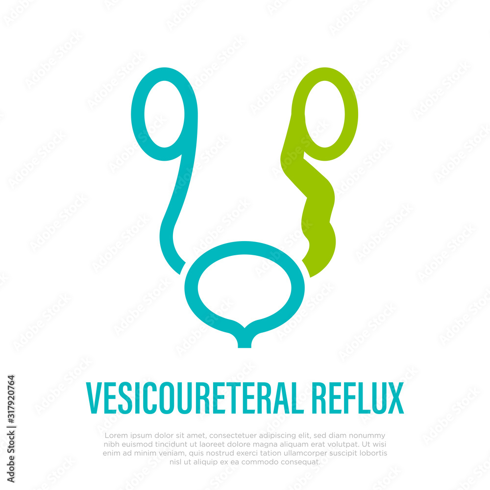 Vesicoureteral reflux. Urine flows backward from bladder into kidneys ...