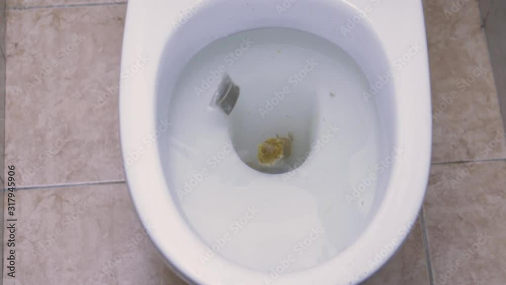 The white toilet is clogged and does not flush human stools. A ...