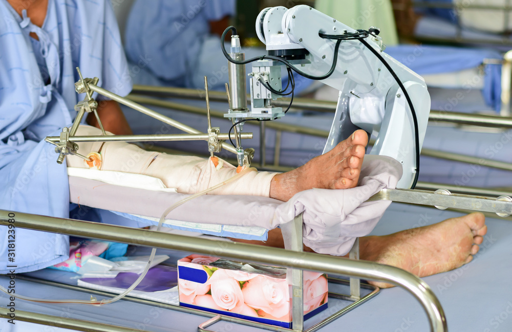 Medical robot arm the technology artificial intelligence patient ...