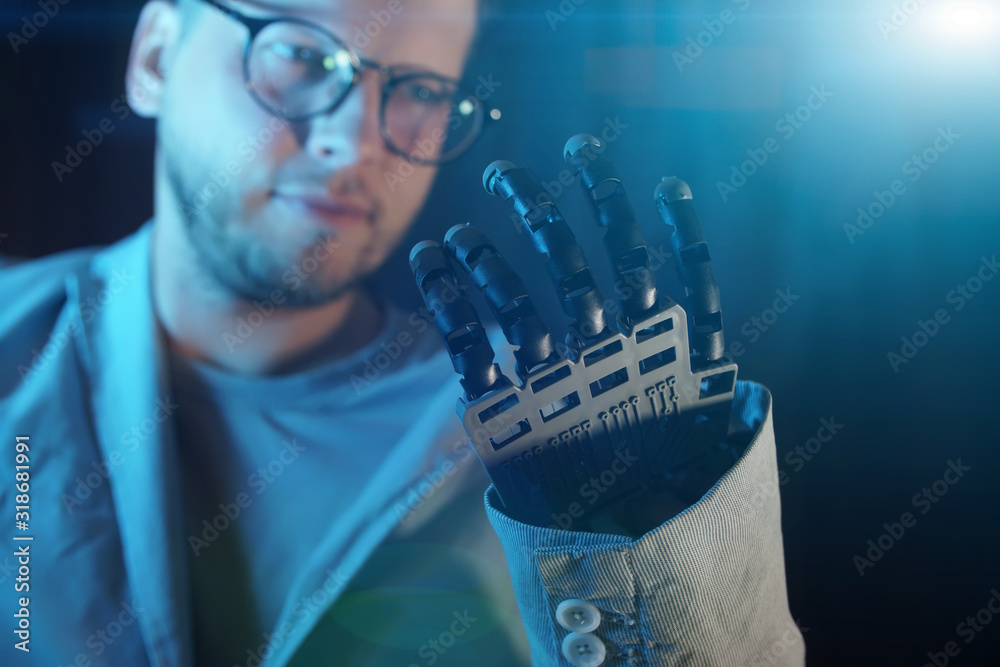 man Controls Electronic Prosthetic Arm Using Bionics Technology Cyber ...