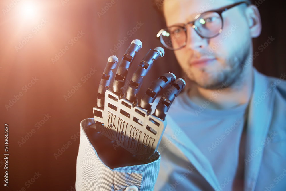 man Controls Electronic Prosthetic Arm Using Bionics Technology Cyber ...