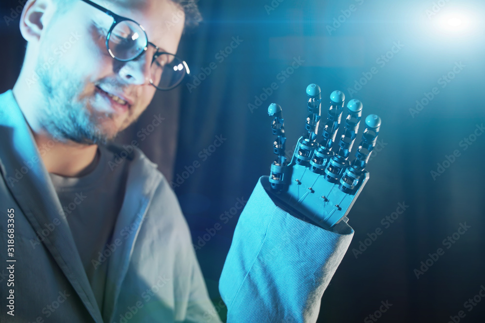 man Controls Electronic Prosthetic Arm Using Bionics Technology Cyber ...