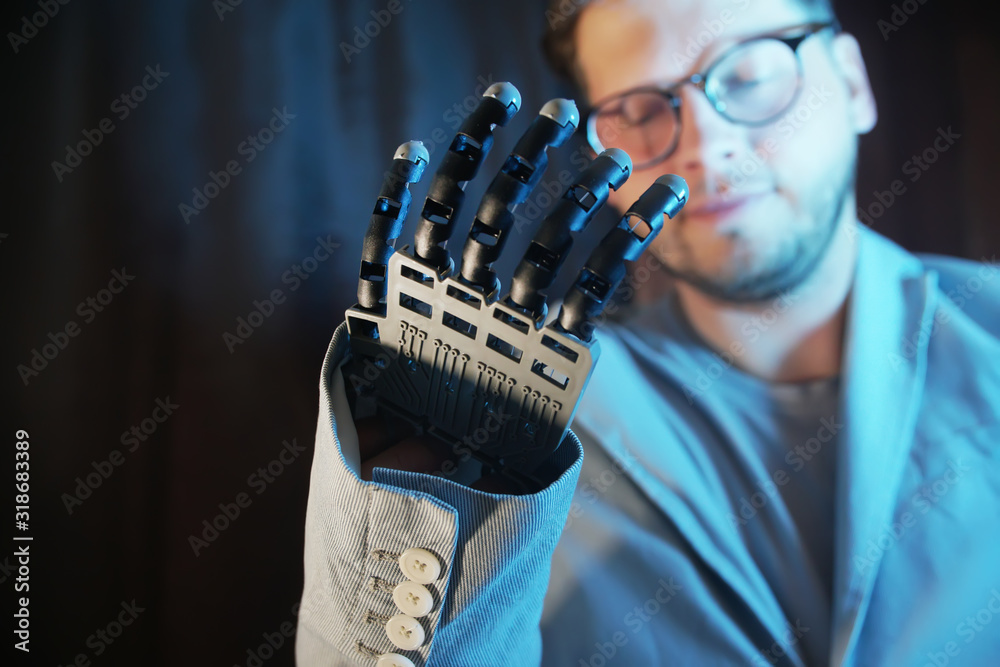 man Controls Electronic Prosthetic Arm Using Bionics Technology Cyber ...