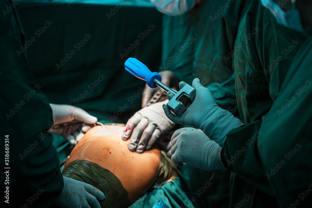 Orthopedic surgeons in teamwork in the operating room with modern ...
