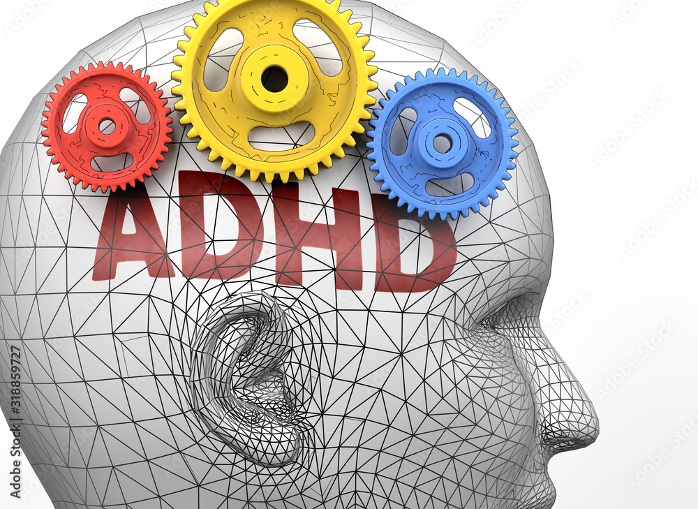 Adhd and human mind - pictured as word Adhd inside a head to symbolize ...