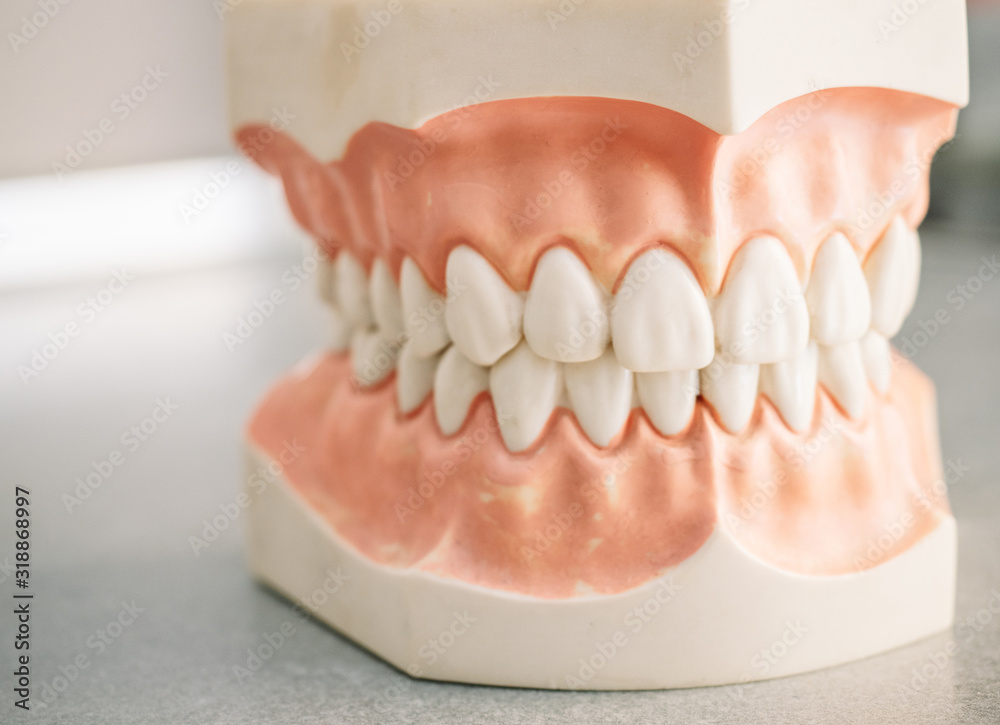 Mould of human teeth. Oral health concept. Mould of human teeth. Close ...